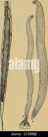 Oxyuris vermicularis female Stock Photo - Alamy