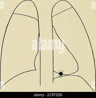 . The heart and the aorta; studies in clinical radiology . ase of ...