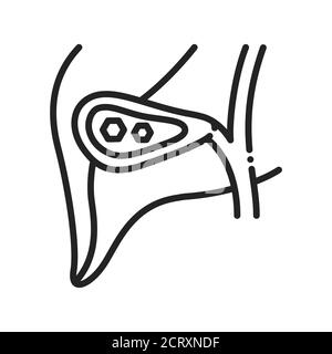 ACUTE PANCREATITIS, ANATOMY Stock Photo - Alamy