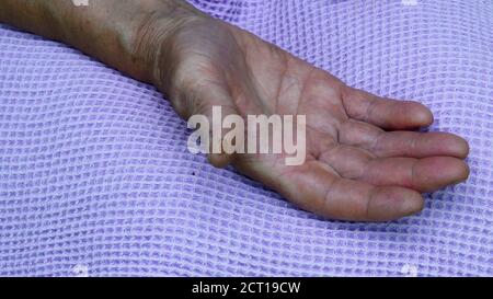 Opened palm hand of senior woman of 80 year old. Damaged wrinkled elder ...