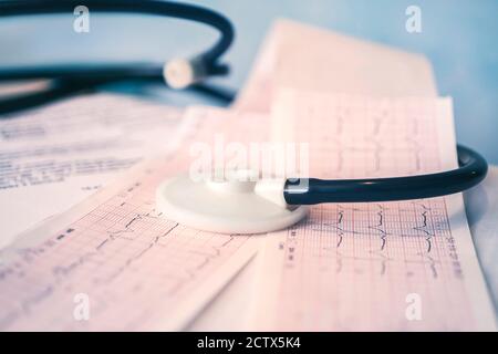 Cardiogram with stethoscope on table, closeup Stock Photo - Alamy