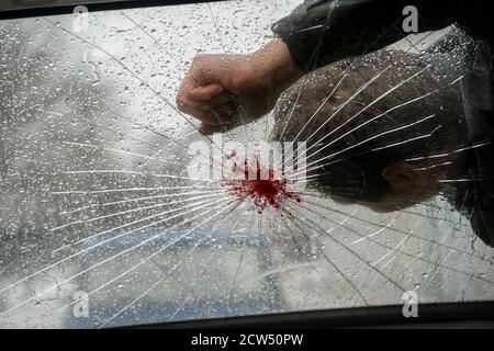 Injured man with a broken head and bleeding wounds sitting on the ...