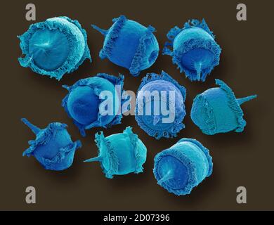 Euplotes protozoa. Coloured scanning electron micrograph (SEM) showing ...