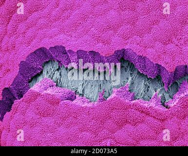 Gall bladder. Coloured scanning electron micrograph (SEM) of the ...
