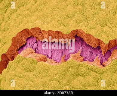 Gall bladder. Coloured scanning electron micrograph (SEM) of the ...