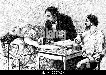 Blood Transfusion - 1882 Stock Photo - Alamy