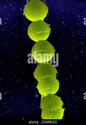 Group A Streptococcus bacteria, SEM Stock Photo - Alamy