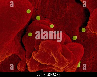 Crimean-Congo haemorrhagic fever virus, illustration Stock Photo - Alamy