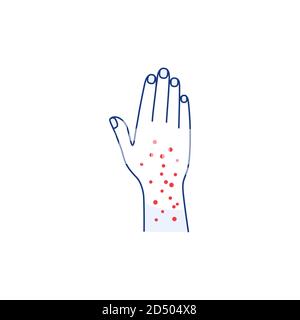 skin rash disease line icon vector illustration Stock Vector Image ...