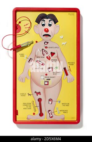 Operation, a battery-operated board game initially produced by Milton ...