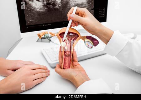Gynecologist showing anatomical model of uterus to patient Stock Photo ...