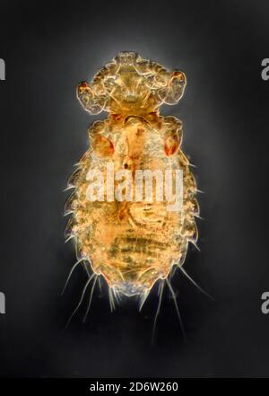 Louse Polyplax serrata female, phase contrast photomicrograph Stock ...