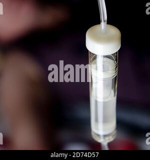 IV Drip Vitamin Infusion Therapy Saline Bag Stock Photo - Alamy