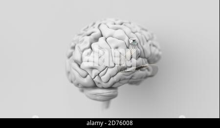 Neurotechnology, implantable brain machine, chip inserted into brain ...