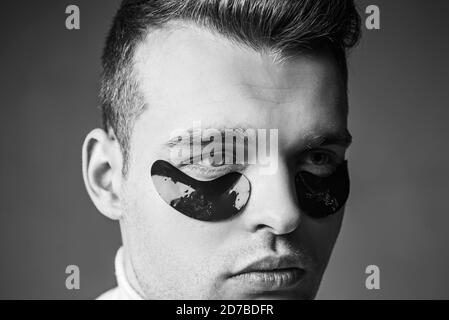Man face with flakes under the eyes. Mans flakes. Patches under close ...