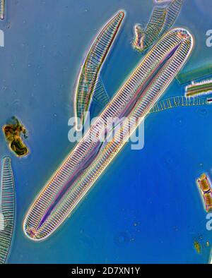 Darkfield / phase contrast photomicrograph, diatom, pinnularia spp ...
