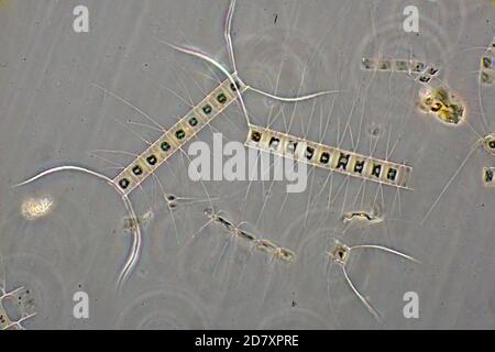 Marine Phytoplankton, Bacteriastrum, Naples, MID 1800's, unpolluted ...