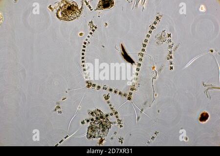 Marine Phytoplankton, Bacteriastrum, Naples, MID 1800's, unpolluted ...