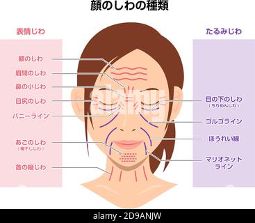 Expression wrinkles and Aging wrinkles ( female face ) vector ...