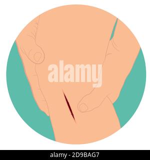 Bloody cut. Bleeding wound. Skin injury mark isolated on white ...