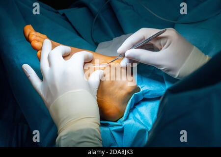 surgeon makes an incision on one foot with a scalpel Stock Photo - Alamy