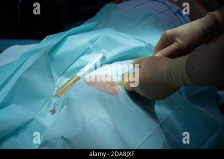a doctor performs a knee puncture in an operating room with a cannula ...