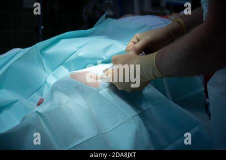 a doctor performs a knee puncture in an operating room with a cannula ...