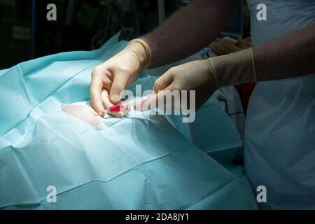 a doctor performs a knee puncture in an operating room with a cannula ...