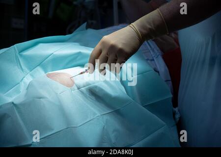 a doctor performs a knee puncture in an operating room with a cannula ...