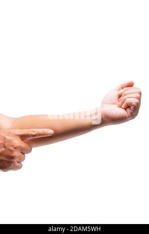 Itching skin lesions with scabs on the hand. Closeup view Stock Photo ...