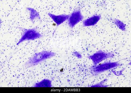Light micrograph of nerve cells (large, blue) and support cells ...