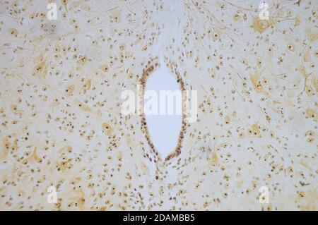 Light micrograph of neurons (nerve cells) from the spinal cord Stock ...