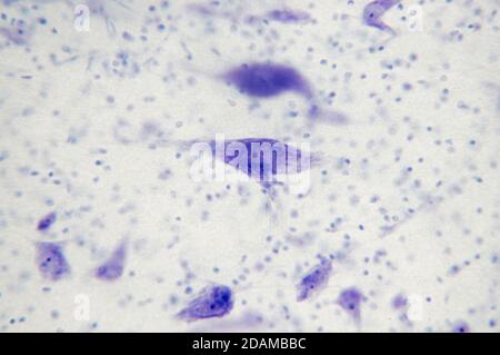 Light micrograph of nerve cells (large, blue) and support cells ...