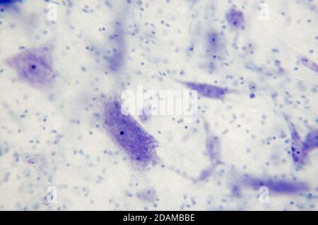 Light micrograph of nerve cells (large, blue) and support cells ...