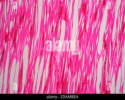 Xylem tissue. Light micrograph (LM) of a section through sunflower ...