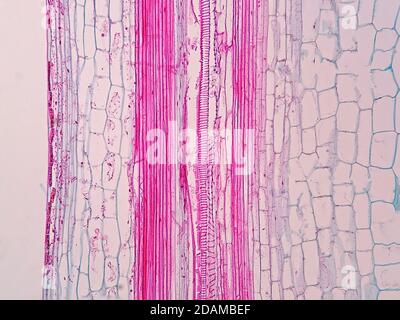 Xylem tissue. Light micrograph (LM) of a section through sunflower ...