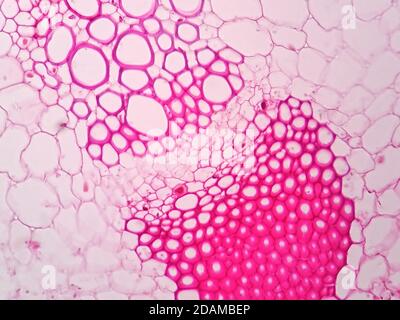 Xylem tissue. Light micrograph (LM) of a section through sunflower ...