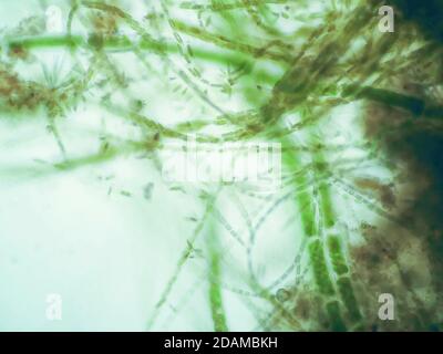 Filamentous algae, light micrograph. Filamentous algae are single algae ...