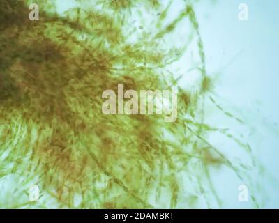 Filamentous algae, light micrograph. Filamentous algae are single algae ...