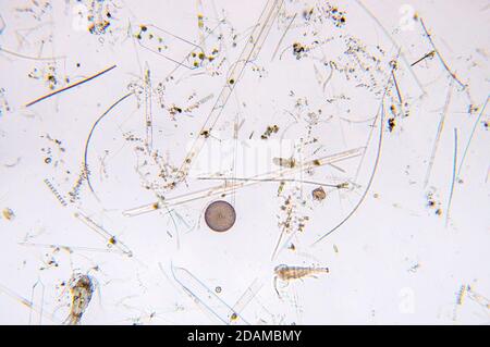 Marine plankton, light micrograph Stock Photo - Alamy