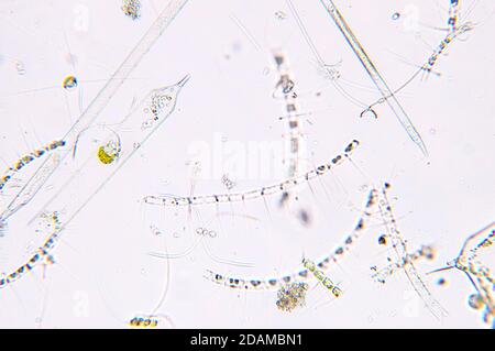 Marine plankton, light micrograph Stock Photo - Alamy