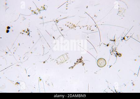 Marine plankton, light micrograph Stock Photo - Alamy