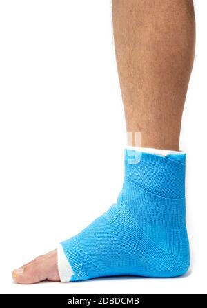 Blue splint ankle. Bandaged leg cast on male patient on light blue ...