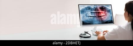 Radiologist Dentist Using X Ray Software On Desktop Computer Stock ...