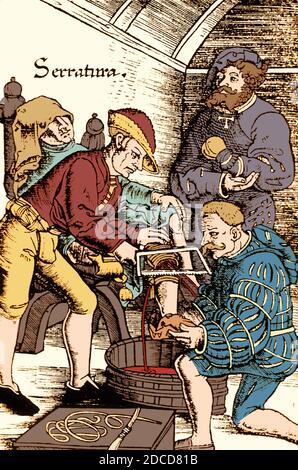 The 16th century illustration of surgery and surgical operations in the ...
