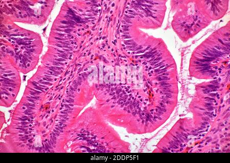 Brightfield photomicrograph, stained section of frog stomach showing ...
