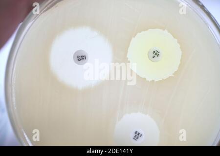 petri dish with antibiotic sensitivity discs showing inhibition zones ...