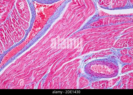 Human Cardiac Muscle Micrograph Stock Photo - Alamy