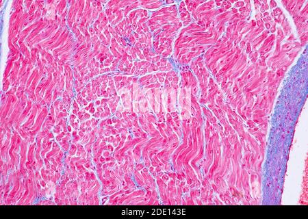 Human Cardiac Muscle Micrograph Stock Photo - Alamy