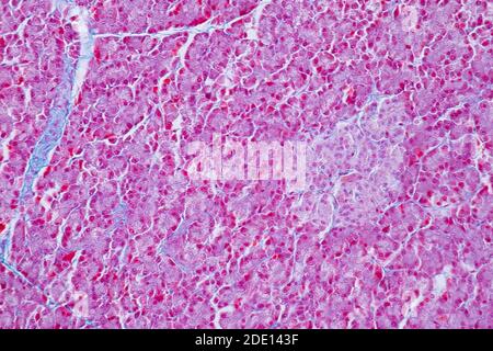 Human liver tissue, light micrograph Stock Photo - Alamy